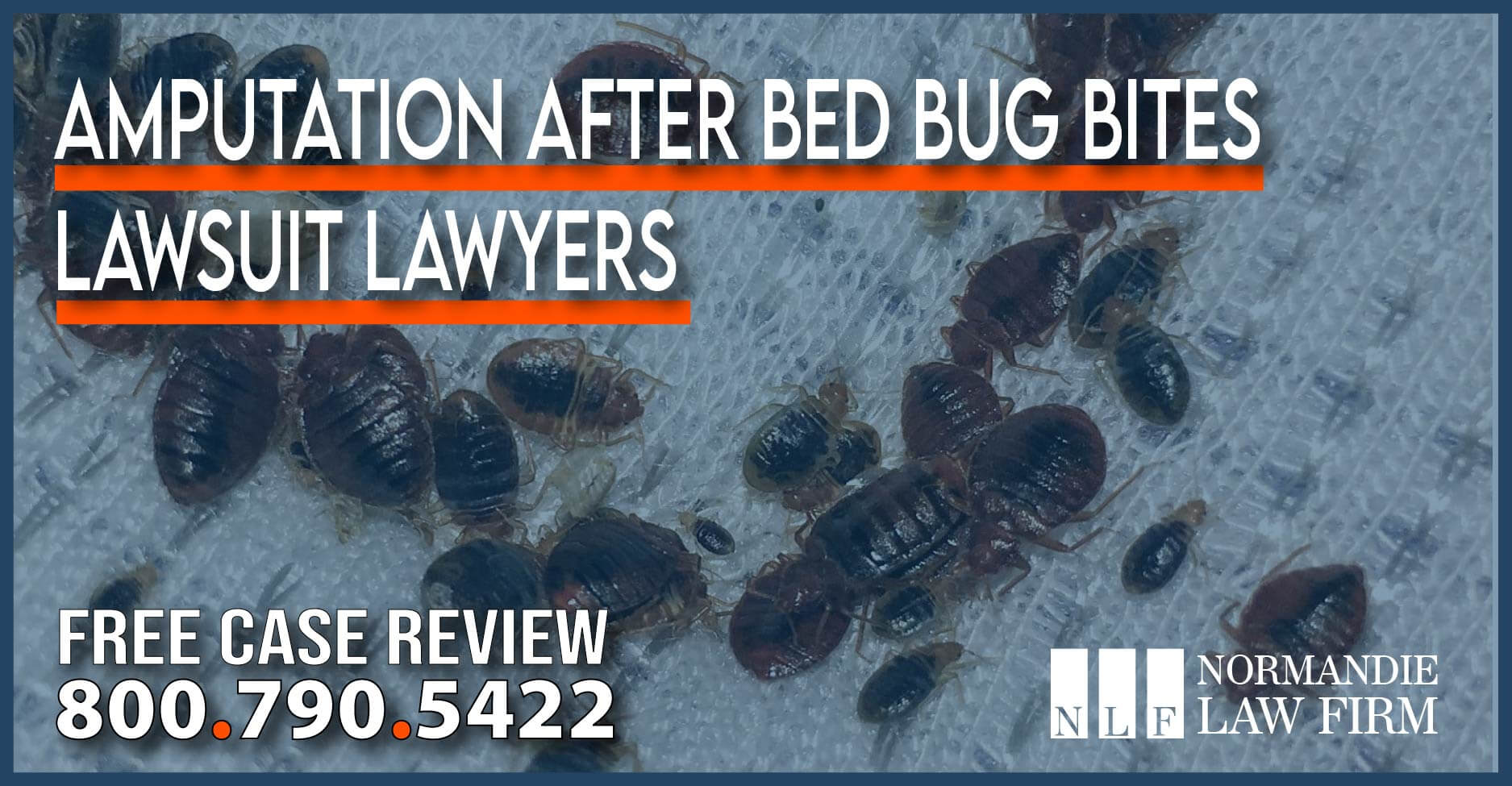 Amputation after Bed Bug Bites Lawsuit Lawyers