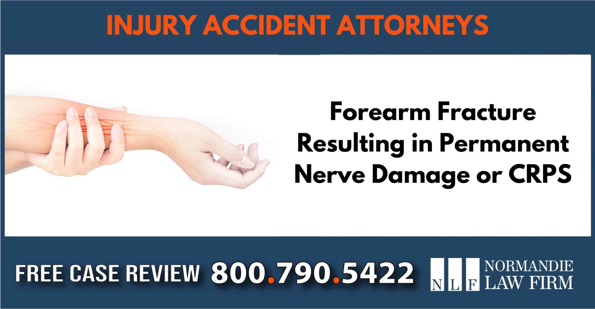 Forearm Fracture Resulting in Permanent Nerve Damage or CRPS